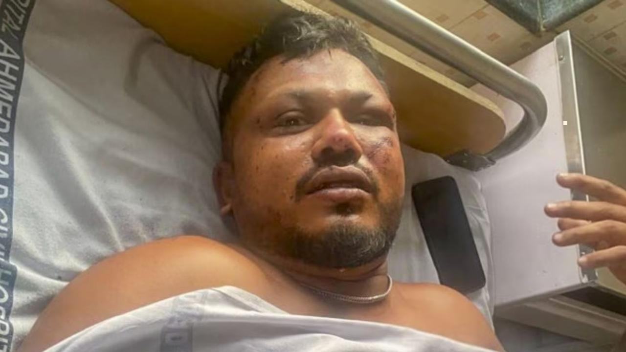 One Survivor in Air India Crash That Killed 241 Onboard